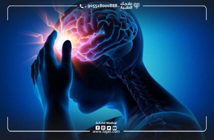 Type de migraine : symptômes, causes et traitement | Ilajak médical