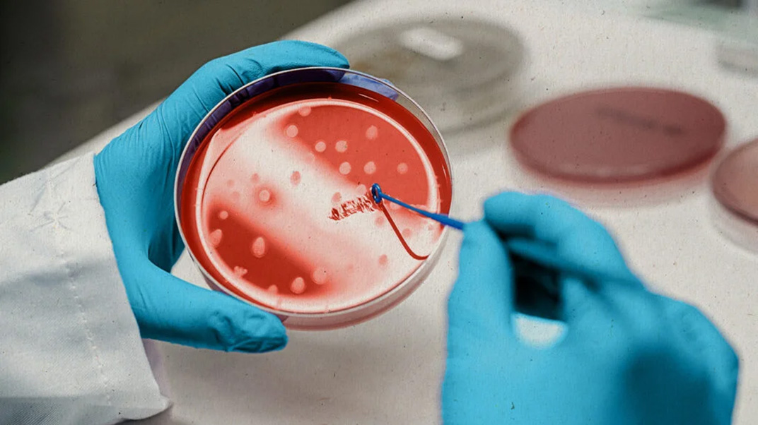 Stem cell therapy in Turkey: cost and top clinics | ILAJAK Medical