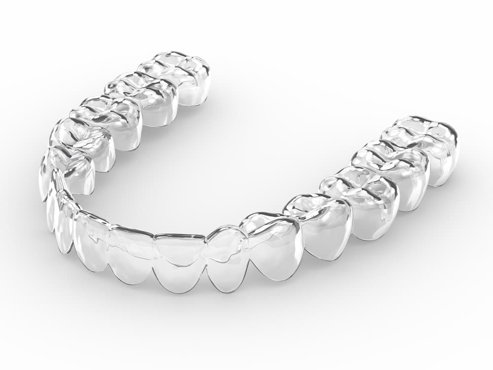 Ilajak médical | Invisalign, l’orthodontie invisible: Comment ...